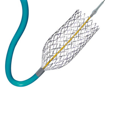 Self-Expanding Stents