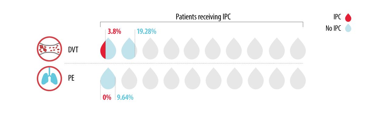 Start with the basics for your blood clot prevention program – the ...